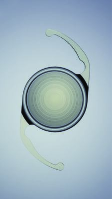 IOL Con - Intraocular Lenses
