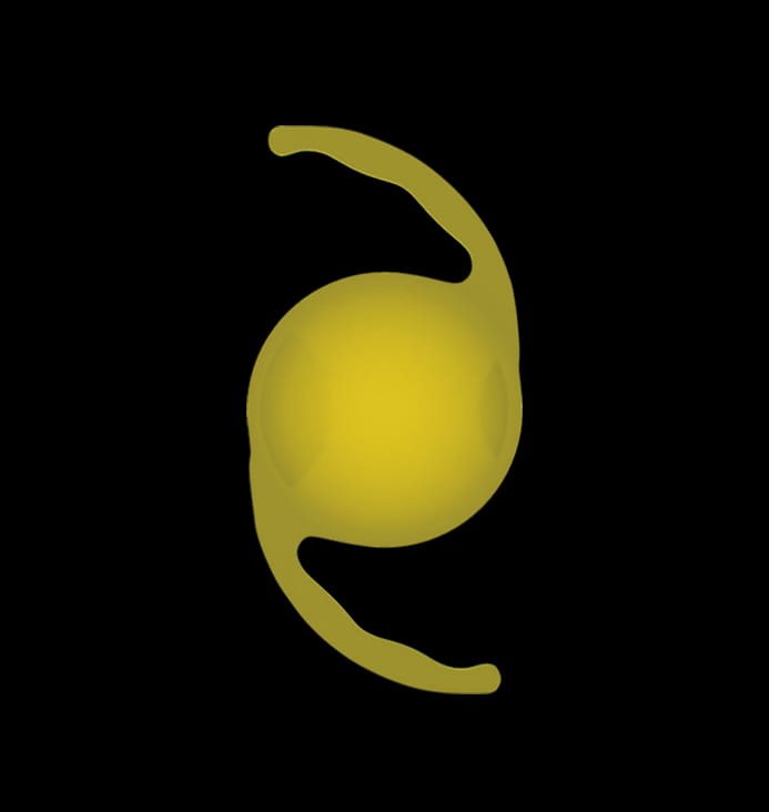 IOL Con - Intraocular Lenses